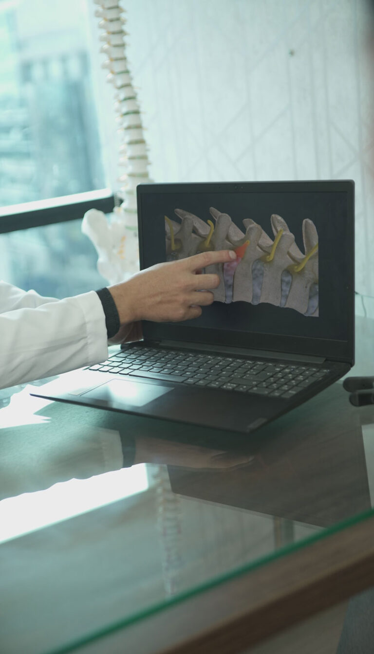 Hernia Discal – Spine Clinica